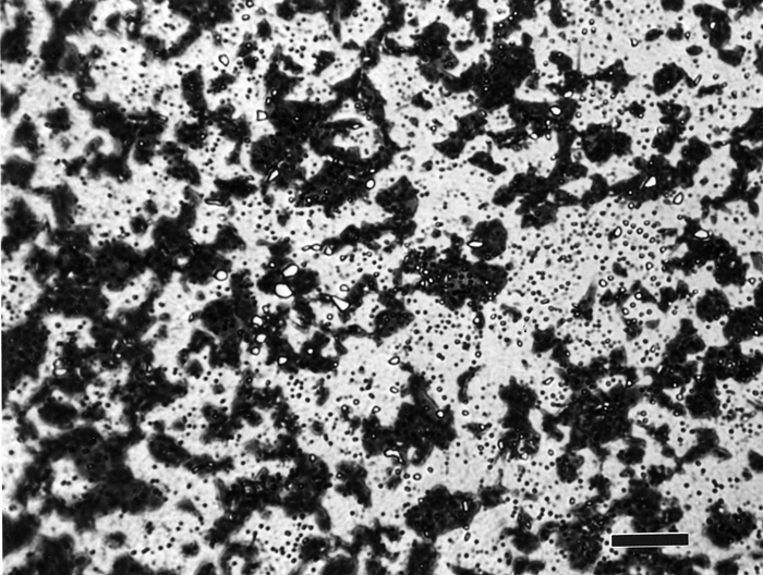 Revealing the Microstructure of Tool Steels